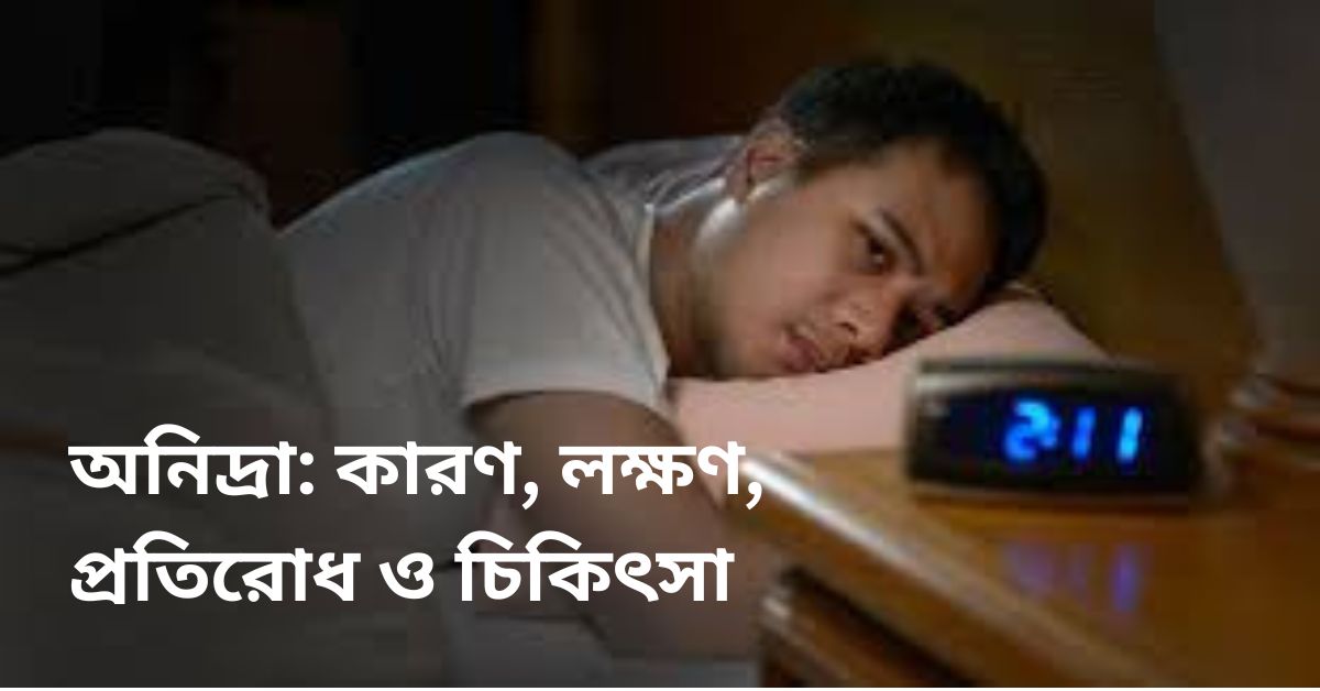 অনিদ্রা: কারণ, লক্ষণ, প্রতিরোধ ও চিকিৎসা - BD Archives